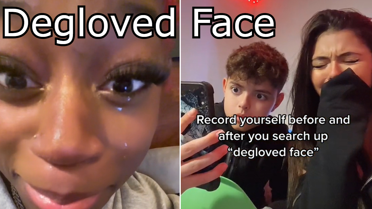 What Is A 'Degloved Face' And Why Are TikTokers Looking It Up? | Know ...