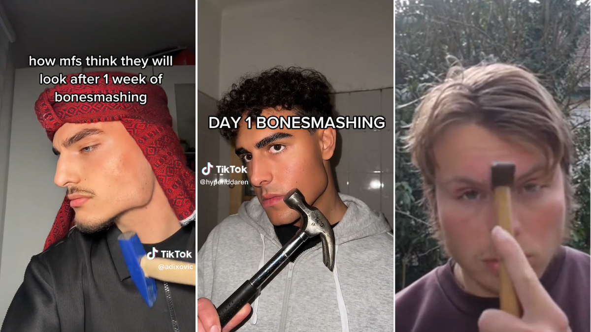 Inside The Bonesmashing Community: Six 'Looksmaxxers' Share Why They ...