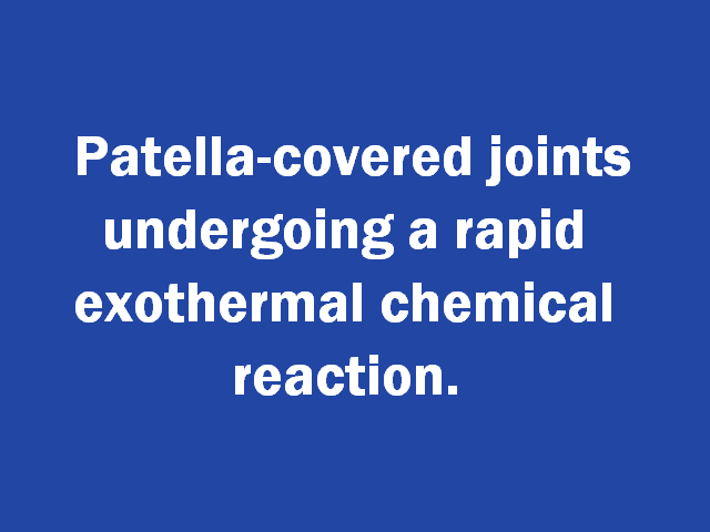 [Image - 541725] | Exploding Knees | Know Your Meme