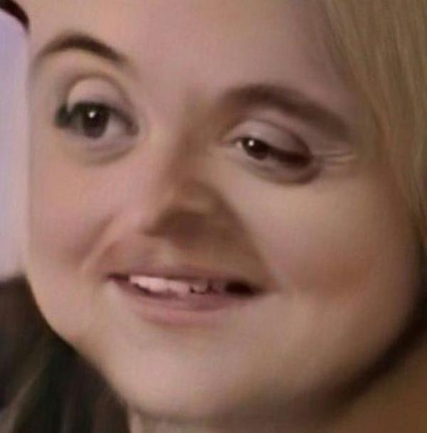 Female ForsenE emote | Forsen | Know Your Meme