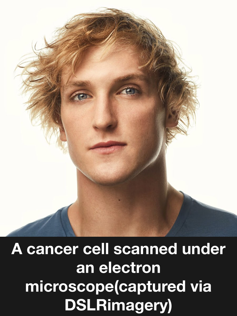 A cancer cell under an electron microscope | Logan Paul | Know Your Meme