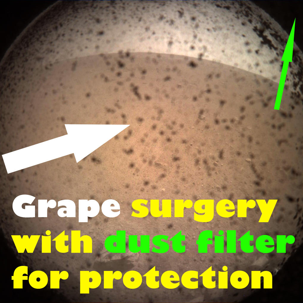 Grape surgery trough dust filter | They Did Surgery On a Grape | Know ...