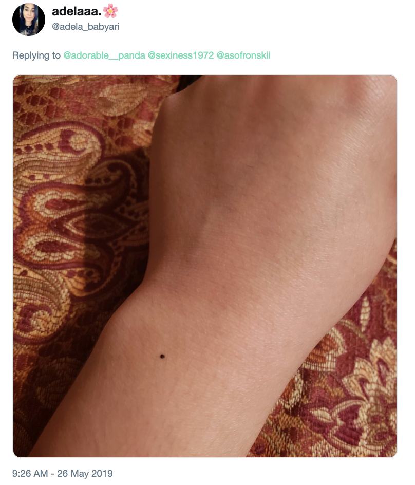 I do | Wrist Freckle | Know Your Meme