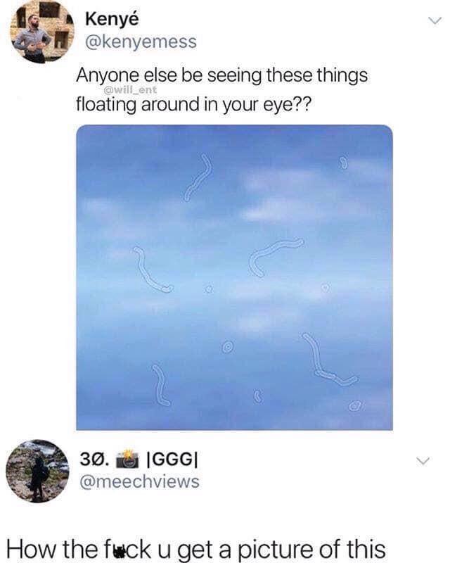 floaters everywhere | r/memes | Know Your Meme