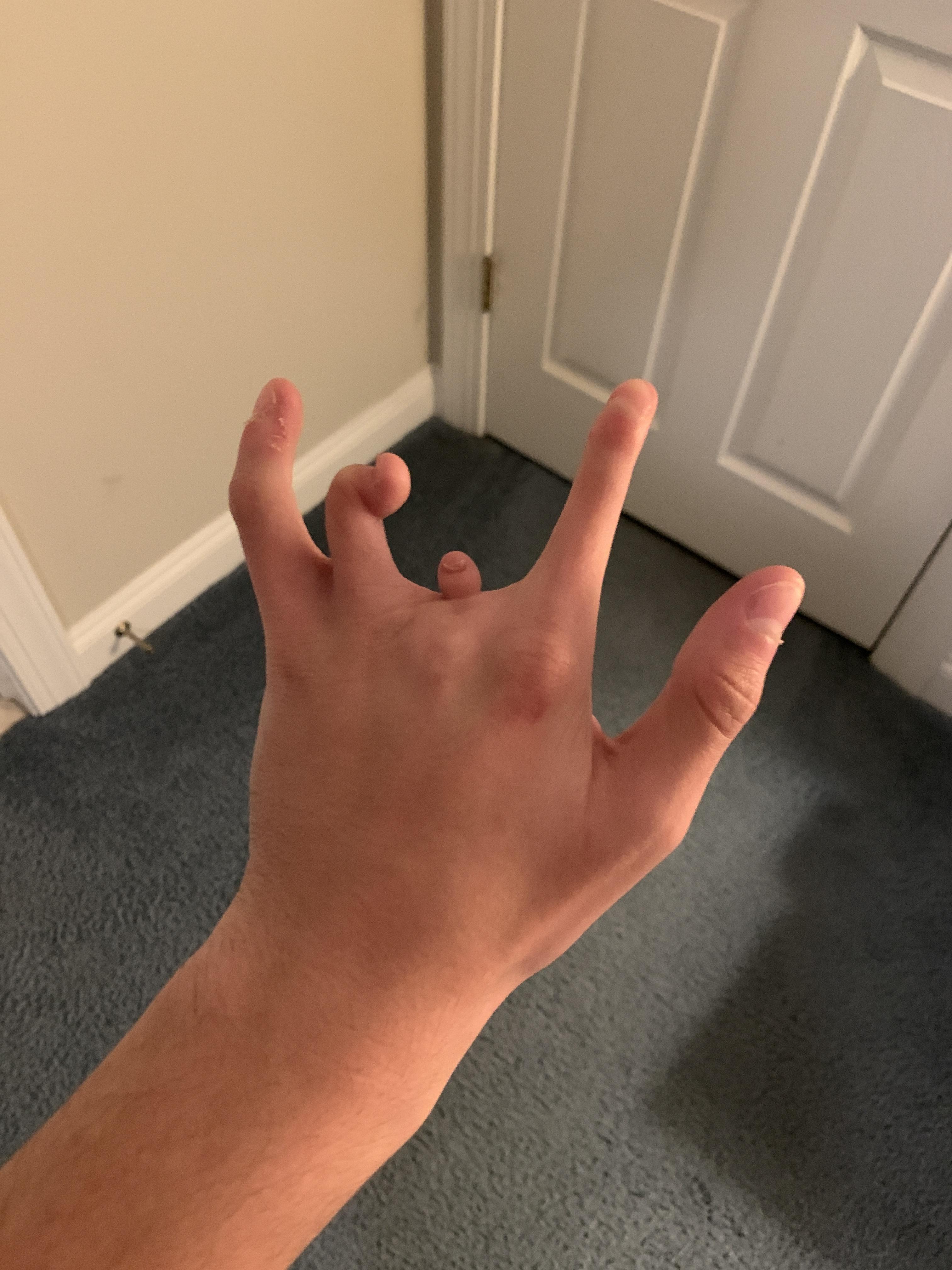 I was born with a really strange hand! Open to absolutely any questions ...