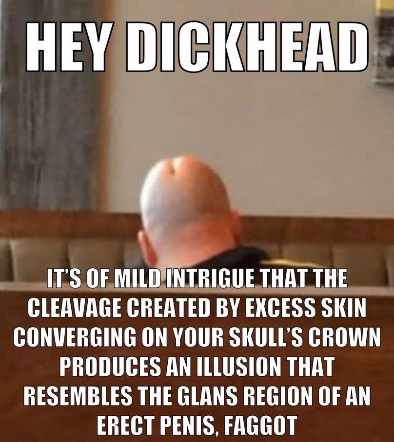 Urethra | /r/okbuddyretard | OkBuddyRetard | Know Your Meme