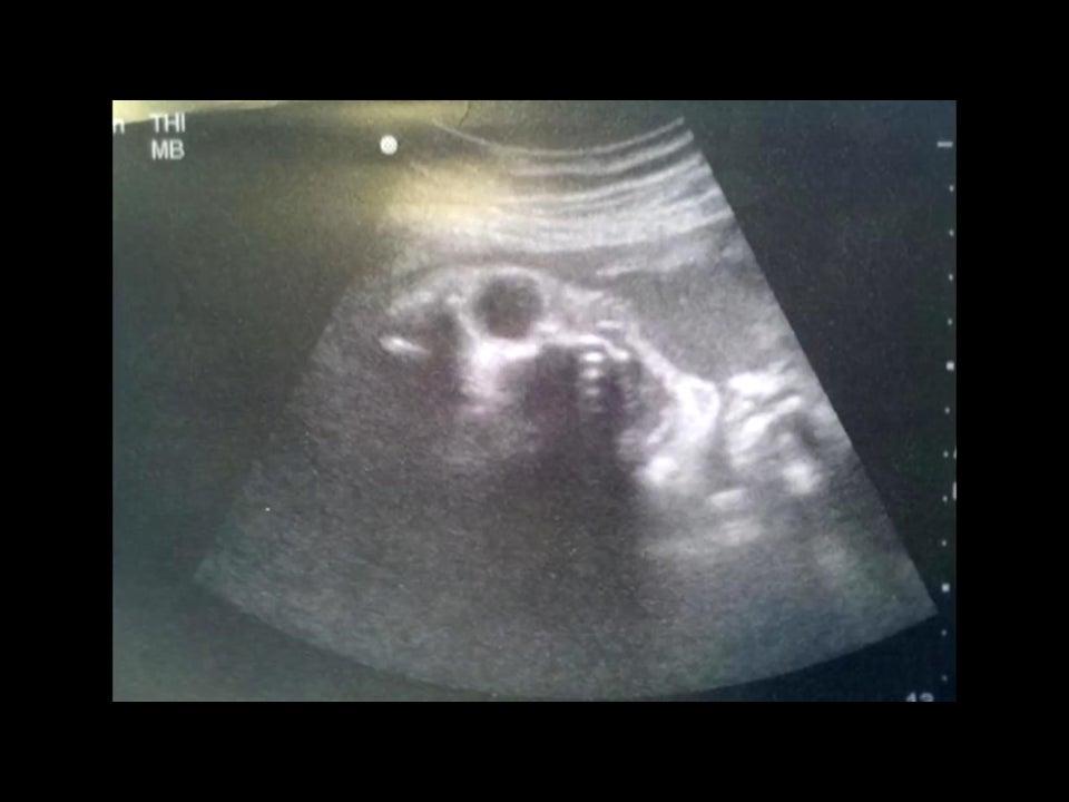 cursed baby | Cursed Images | Know Your Meme