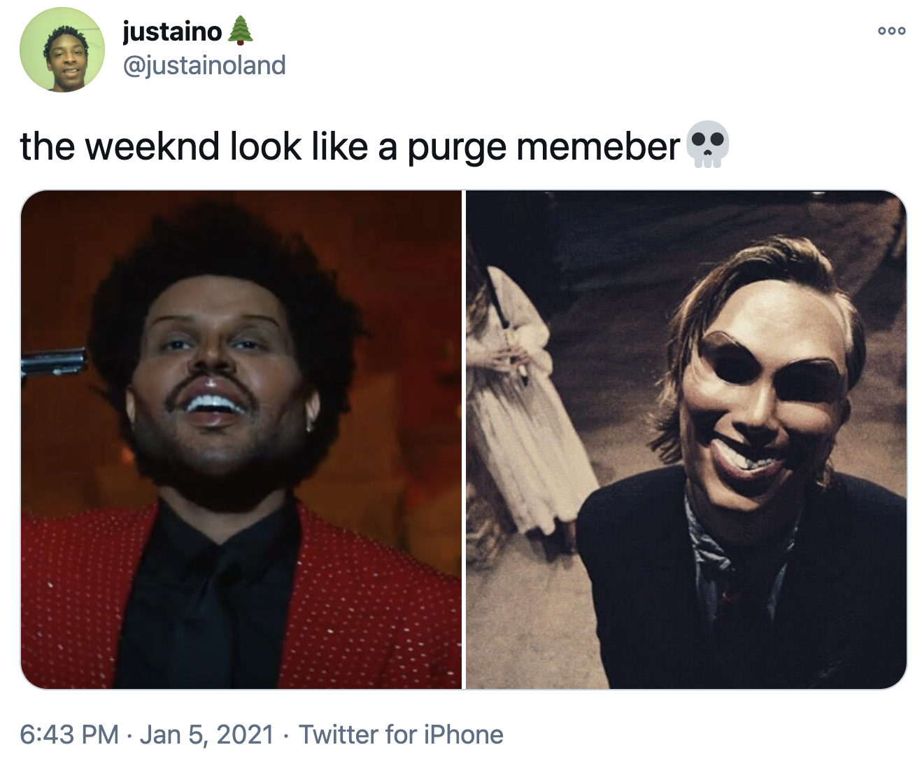 the weeknd look like a purge memeber | The Weeknd's Plastic Surgery ...