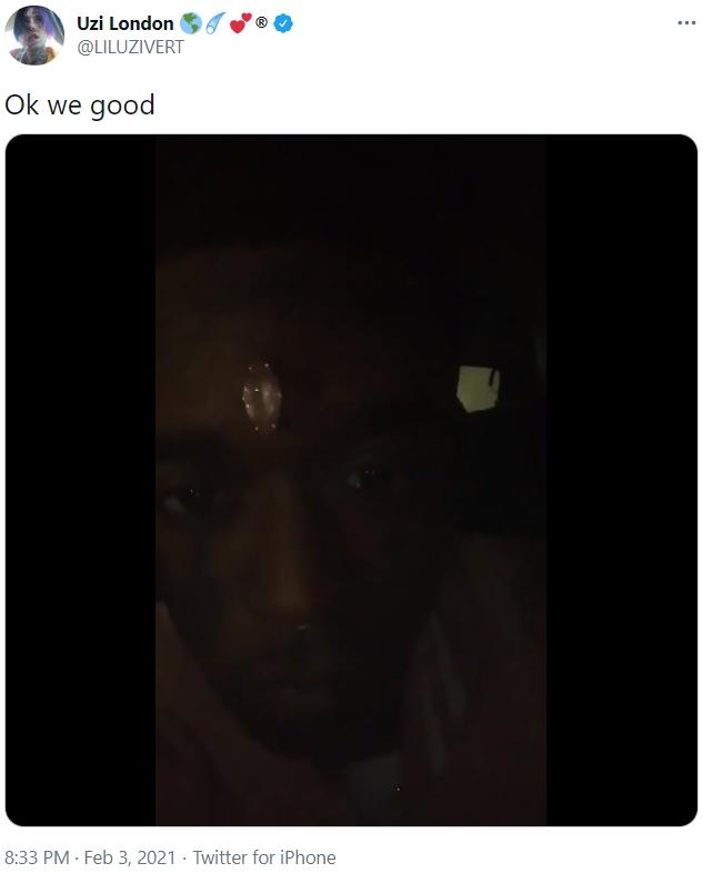 Lil Uzi Vert With Diamond Installed | Lil Uzi Vert's Forehead Diamond ...