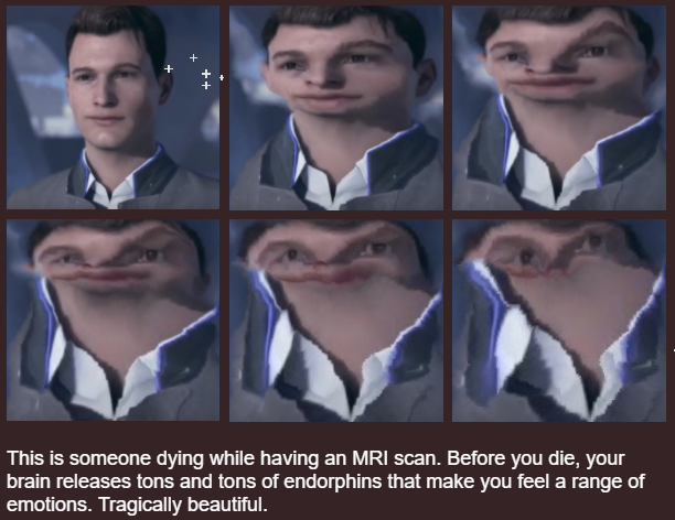 he die | This Is Someone Dying While Having an MRI Scan | Know Your Meme