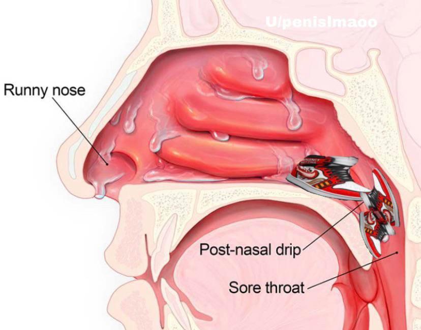 Nasal Drip Drip Know Your Meme