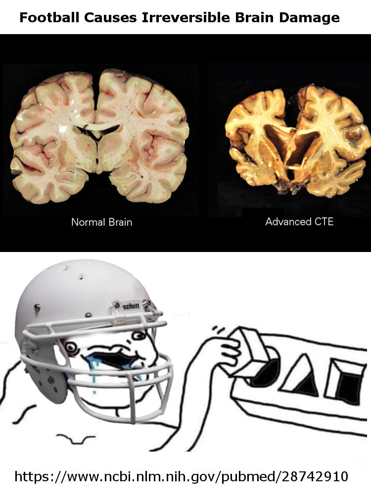 Football brain wojak | Brainlet | Know Your Meme