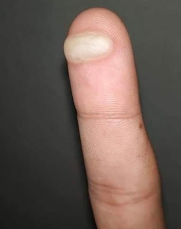 Blursed_Finger | Blursed Images | Know Your Meme