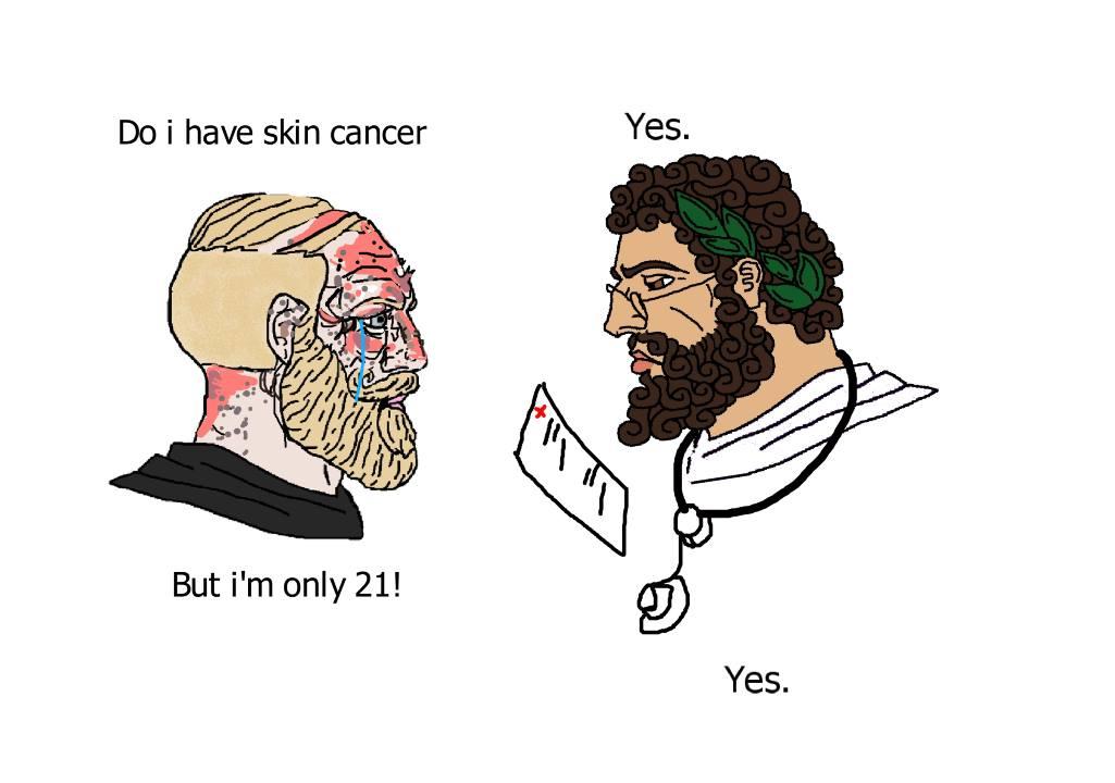 Nordic Chad can't handle the sun | Nordic / Mediterranean | Know Your Meme