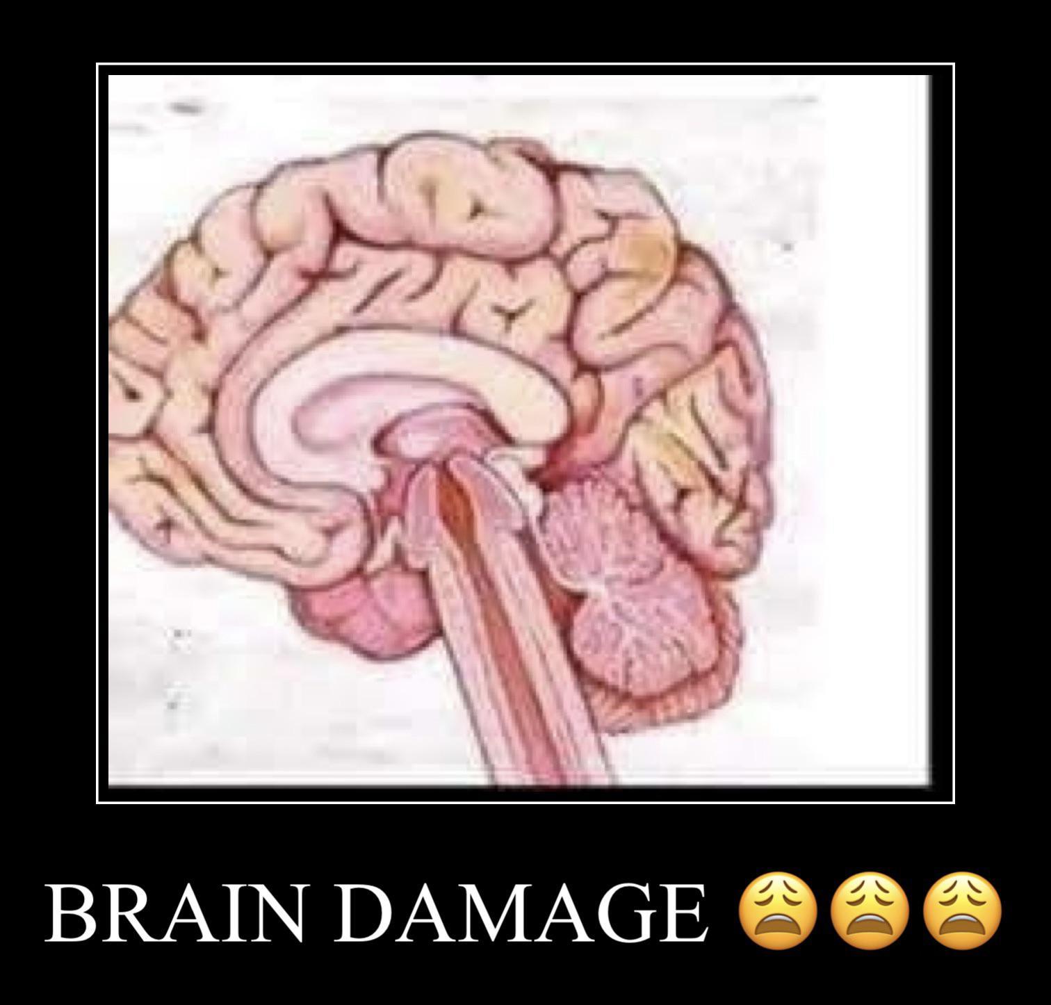 Brain hurts | /r/okbuddyretard | OkBuddyRetard | Know Your Meme