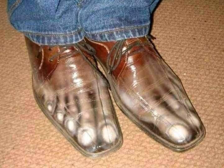 Scariest Toes Ever | WTF | Know Your Meme