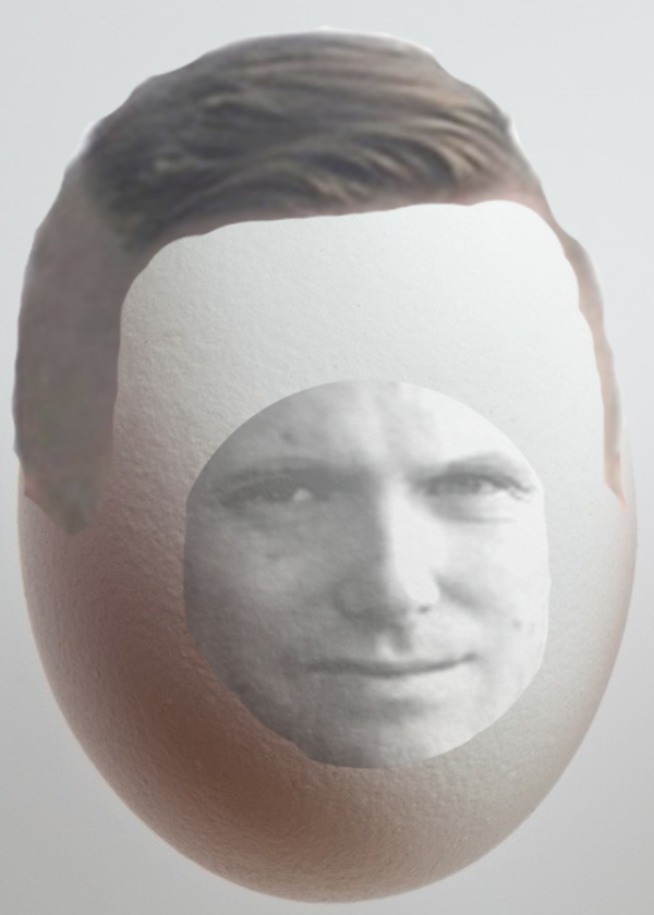 Richard Spencer Big Forehead (Meme) | Richard Spencer Big Forehead ...