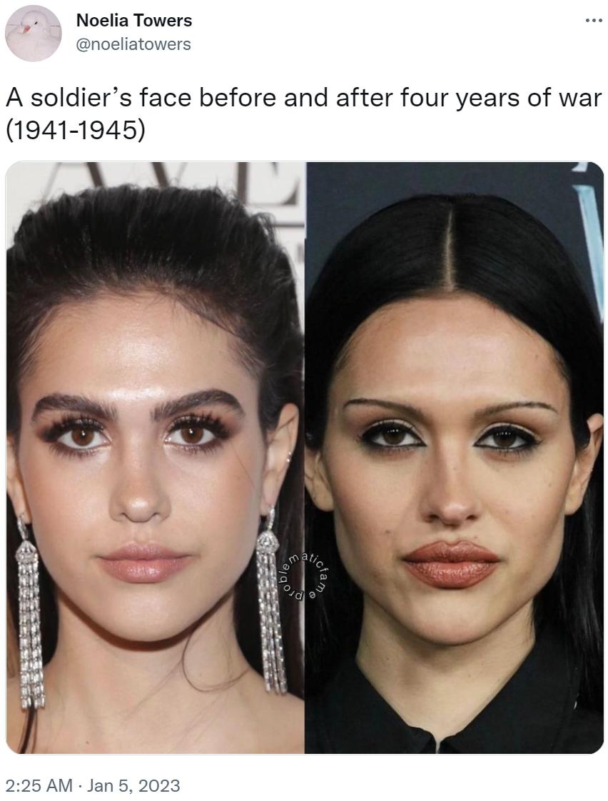 A soldier’s face before and after four years of war (1941-1945 ...