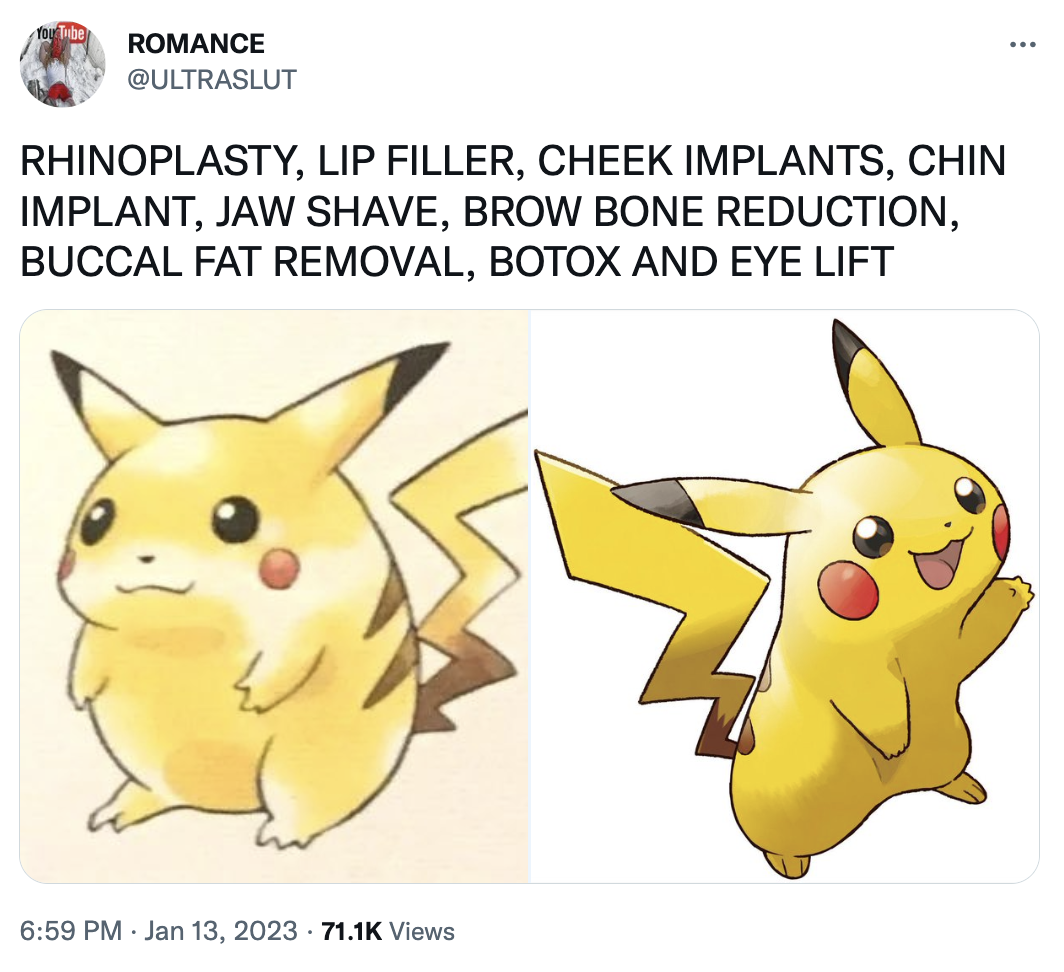 Rhinoplasty, Lip Filler, Cheek Implants (Pikachu) | Rhinoplasty, Lip ...