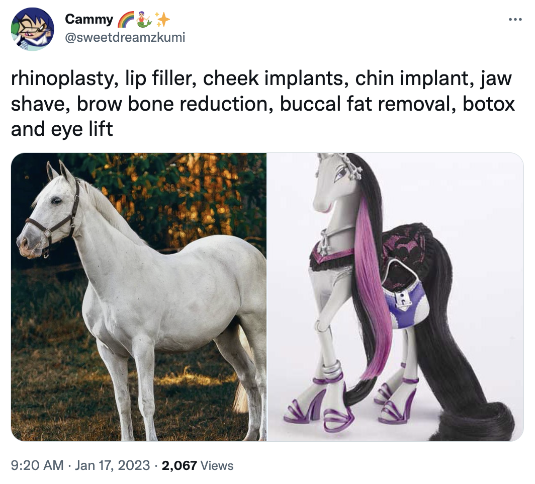 Rhinoplasty, Lip Filler, Cheek Implants (Meme) | Rhinoplasty, Lip ...