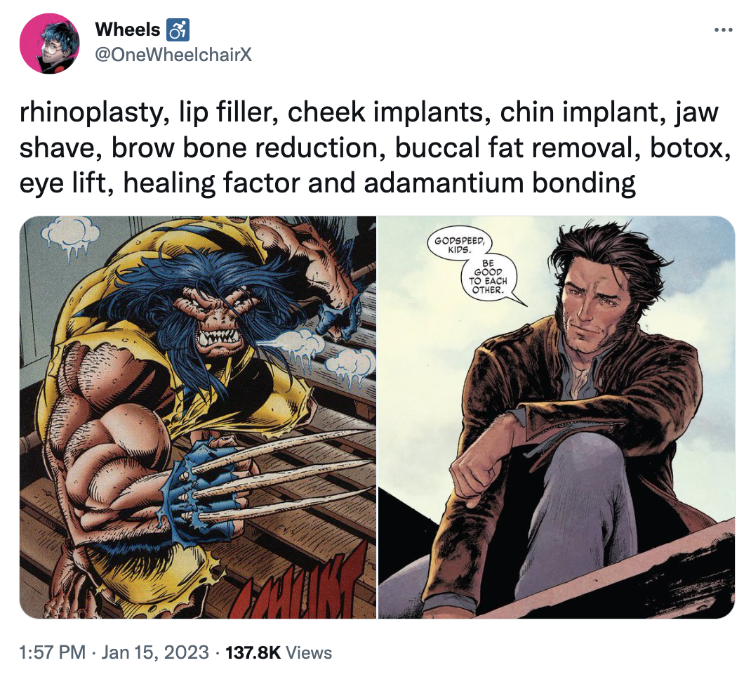 Rhinoplasty, Lip Filler, Cheek Implants (Wolverine) | Rhinoplasty, Lip ...