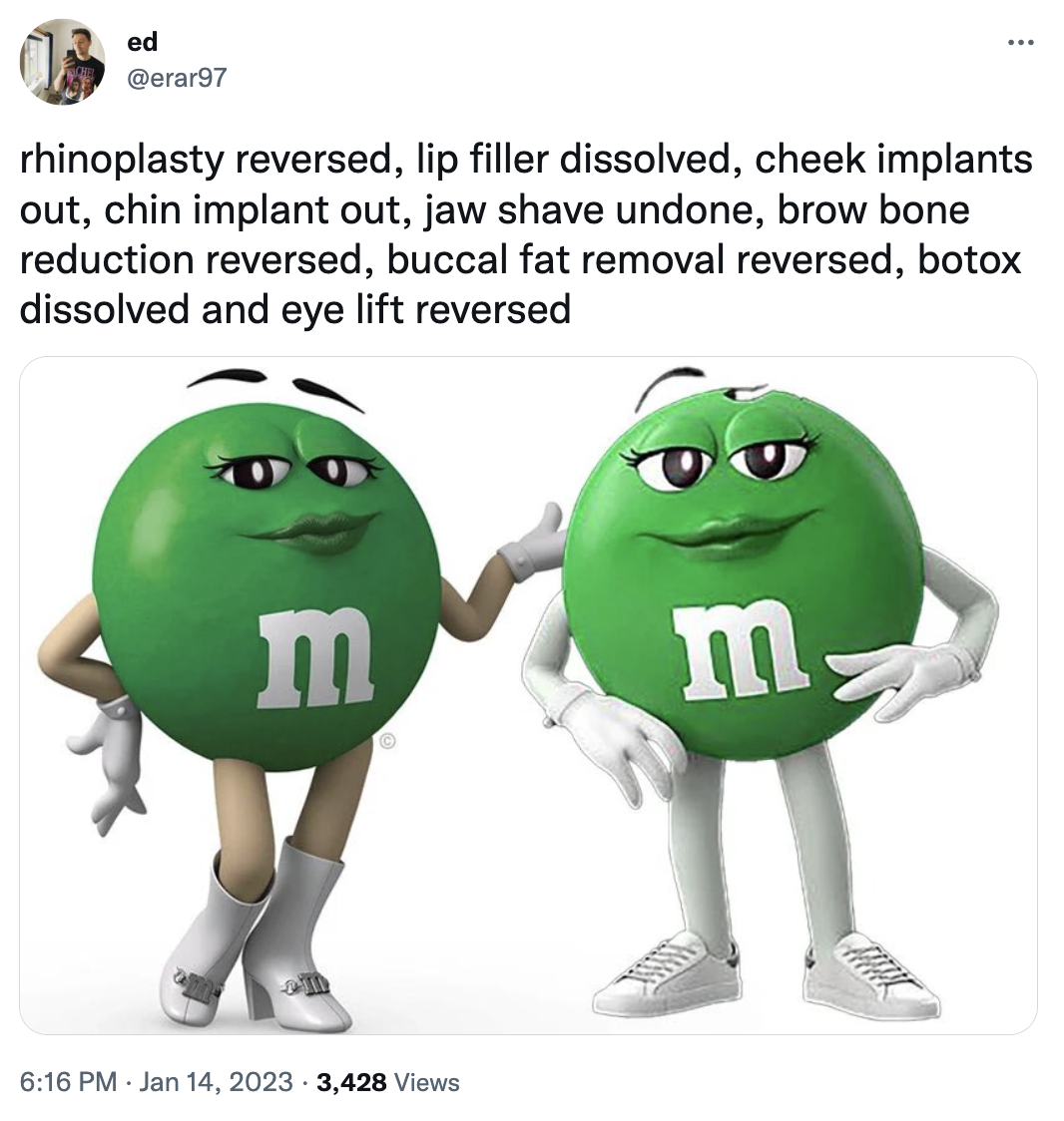 Rhinoplasty, Lip Filler, Cheek Implants (Green M&M) | Rhinoplasty, Lip ...