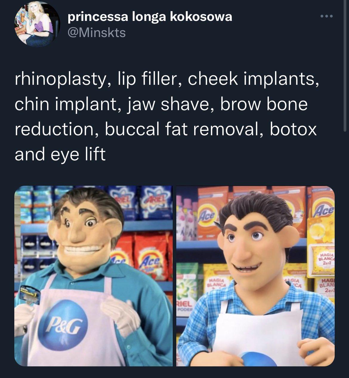 Don Pepe | Rhinoplasty, Lip Filler, Cheek Implants, Chin Implant, Jaw ...