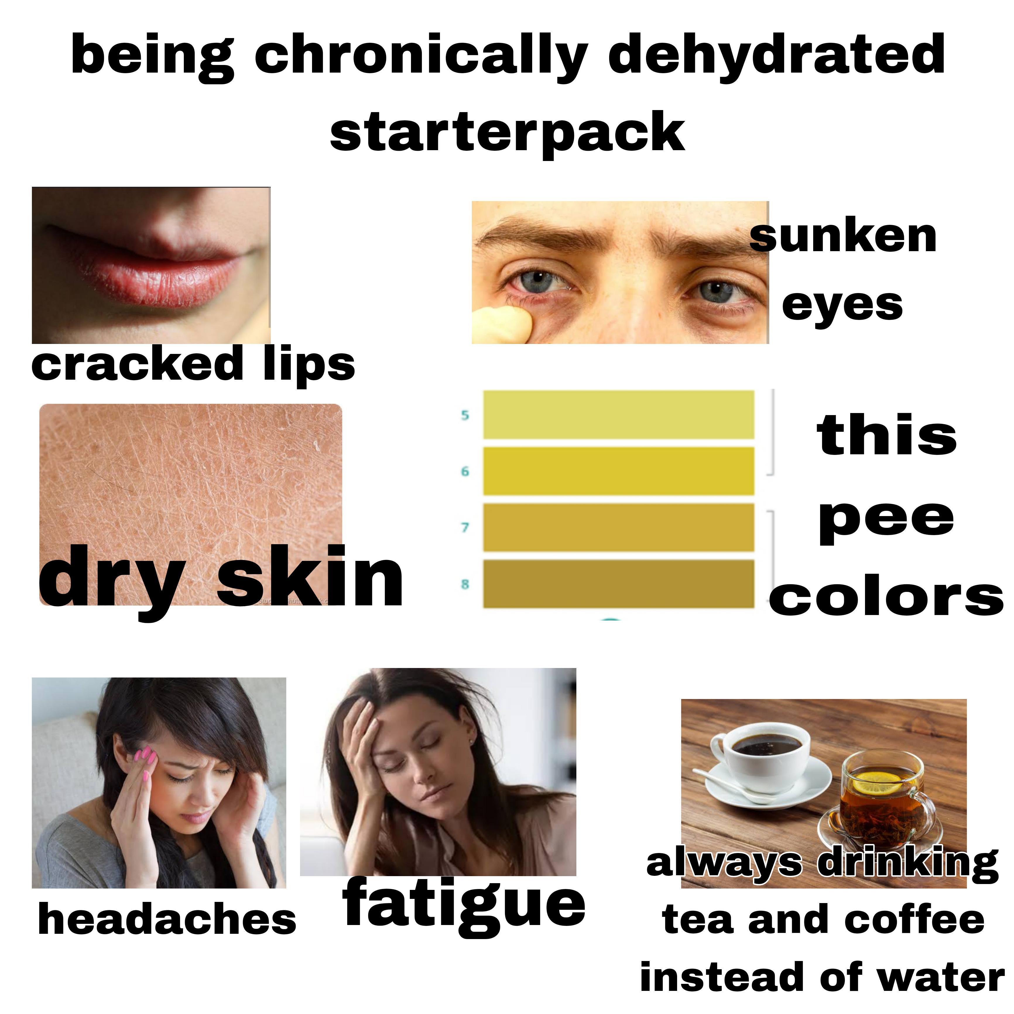 being chronically dehydrated starterpack | /r/starterpacks | Starter ...