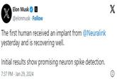 Neuralink Brain Chip Implant | Know Your Meme