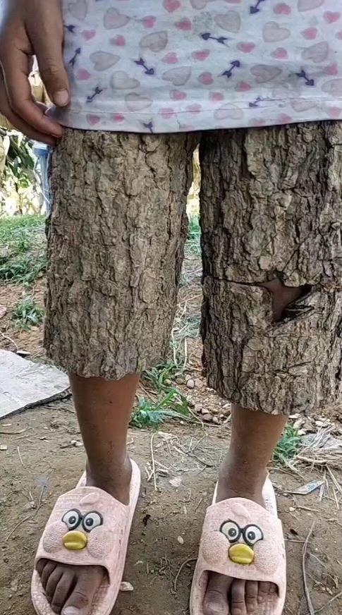 tree pants | Know Your Meme