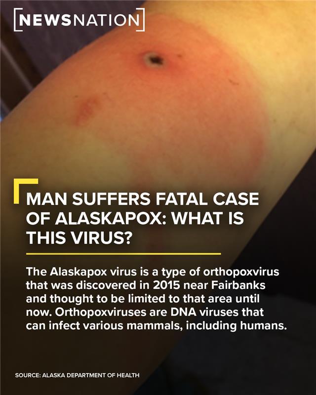 alaskapox | Alaskapox | Know Your Meme