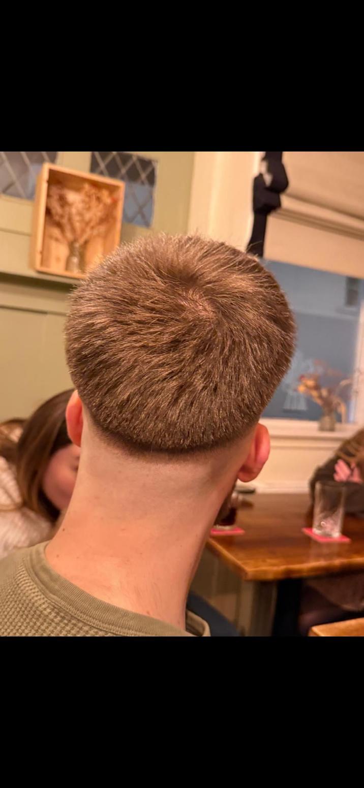 Skin fade | Know Your Meme