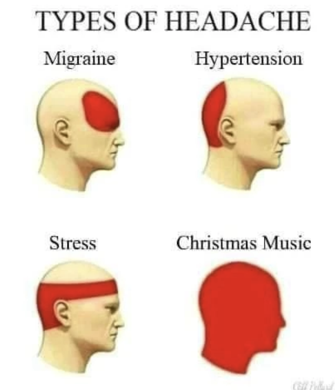Seasonal Allergies Types Of Headaches Know Your Meme